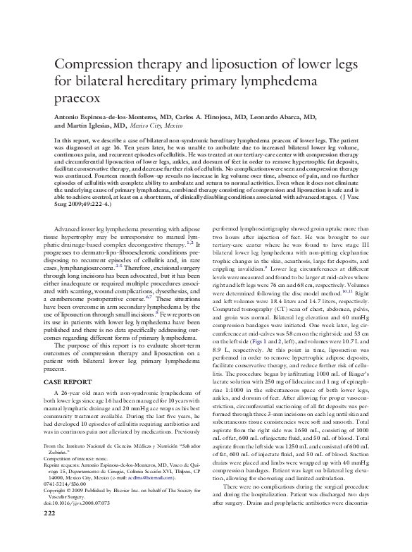 (PDF) Compression therapy and liposuction of lower legs for bilateral ...