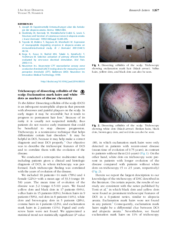 (PDF) Trichoscopy of dissecting cellulitis of the scalp: Exclamation ...