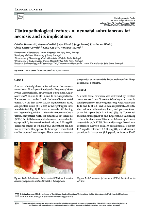 (PDF) Clinicopathological features of neonatal subcutaneous fat ...