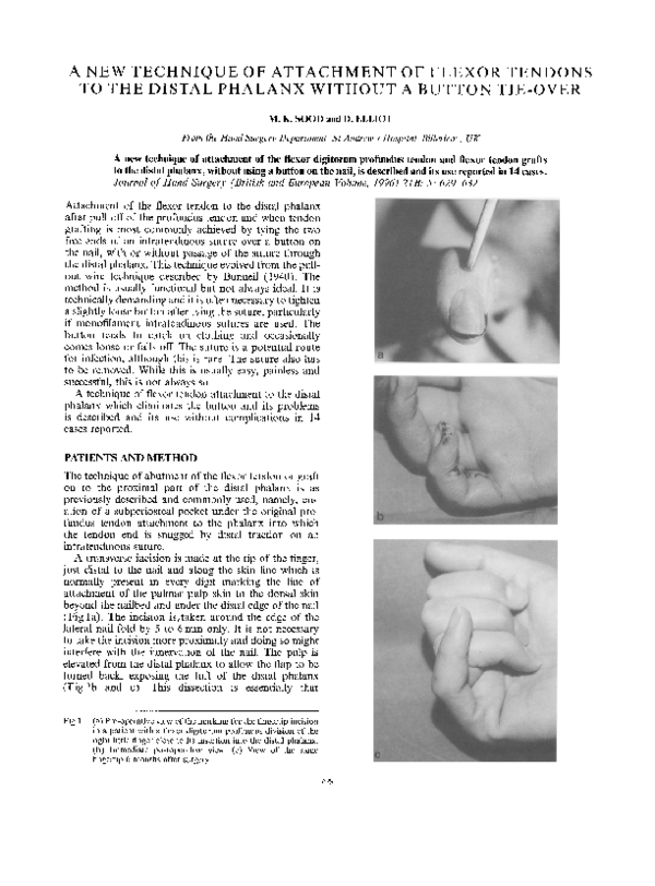 (PDF) A new technique of attachment of flexor tendons to the distal ...