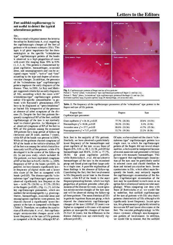 (PDF) Feet nailfold capillaroscopy is not useful to detect the typical ...