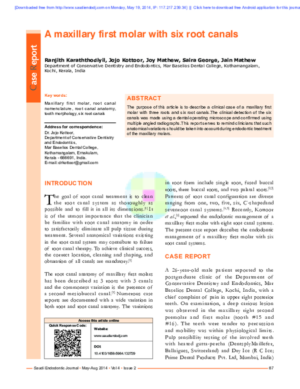(PDF) A maxillary first molar with six root canals