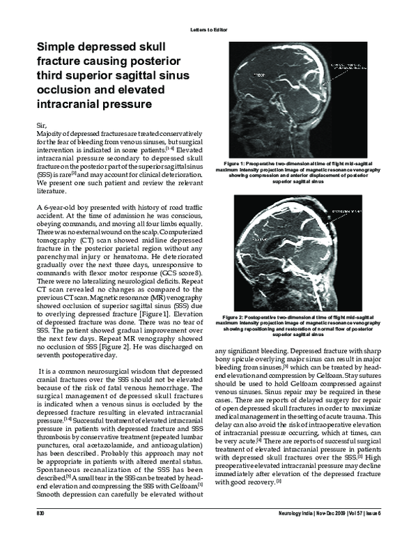 (PDF) Simple depressed skull fracture causing posterior third superior ...