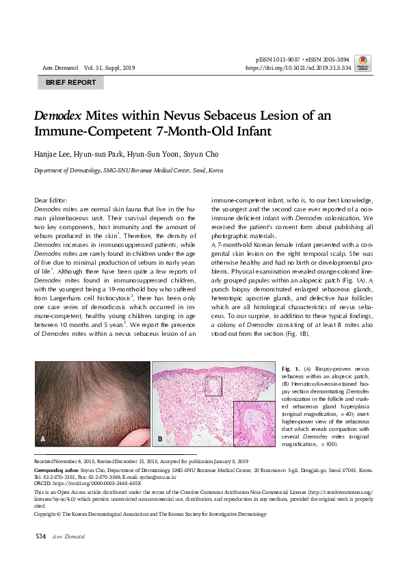 (PDF) Demodex Mites within Nevus Sebaceus Lesion of an Immune-Competent ...