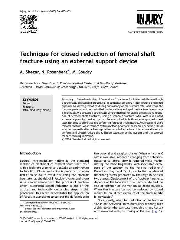 (PDF) Technique for closed reduction of femoral shaft fracture using an ...