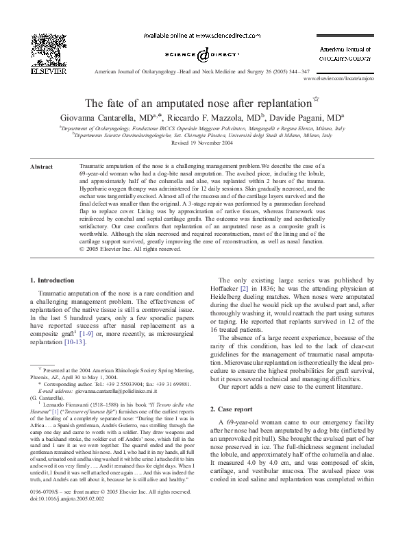 (PDF) The fate of an amputated nose after replantation