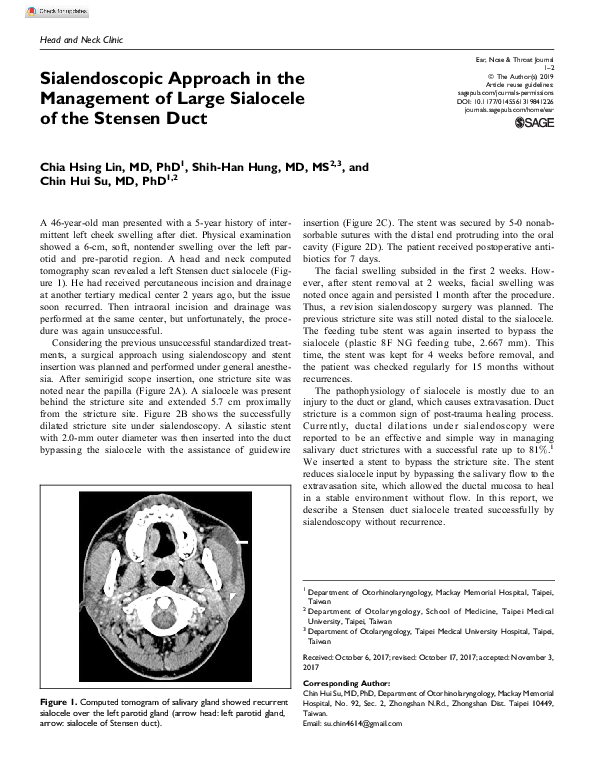 (PDF) Sialendoscopic Approach in the Management of Large Sialocele of ...