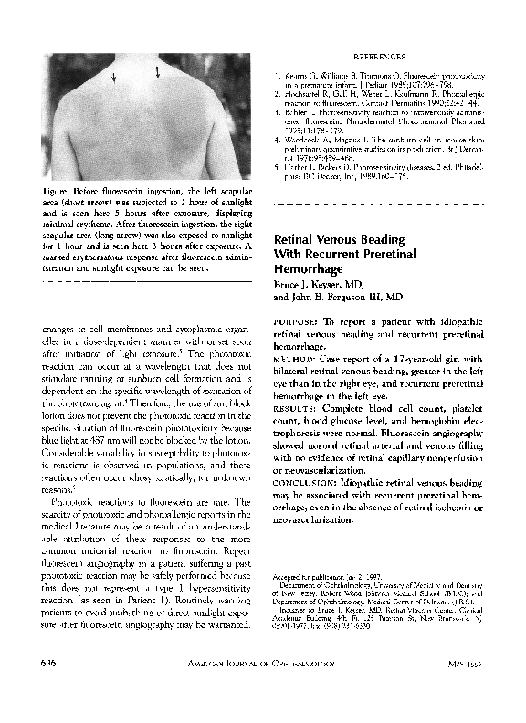 (PDF) Retinal Venous Beading With Recurrent Preretinal Hemorrhage ...