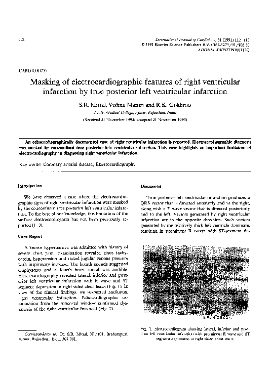 (PDF) Masking of electrocardiographic features of right ventricular ...