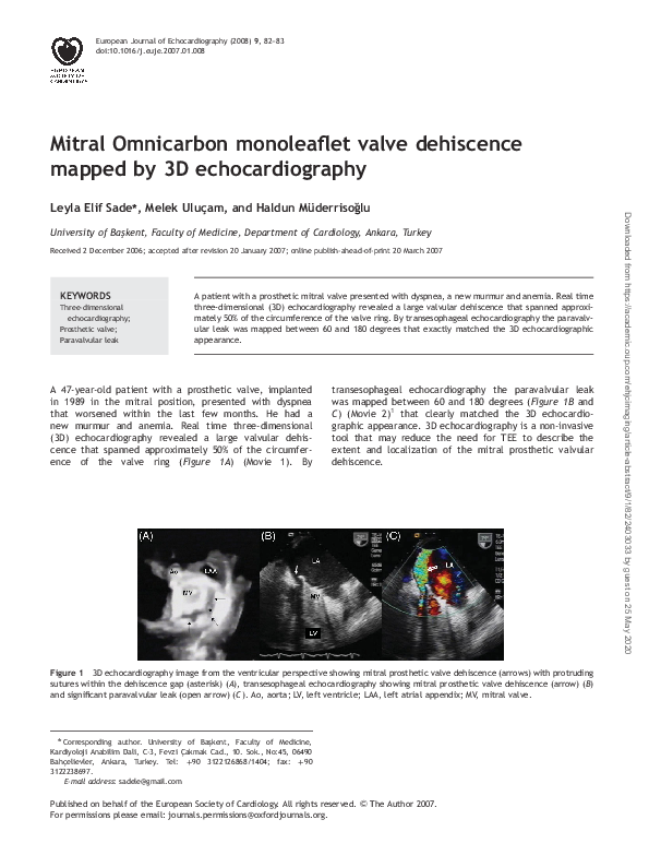 (PDF) Mitral Omnicarbon monoleaflet valve dehiscence mapped by 3D ...