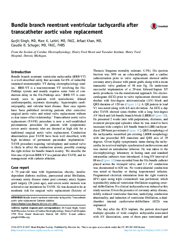 (PDF) Bundle branch reentrant ventricular tachycardia after ...