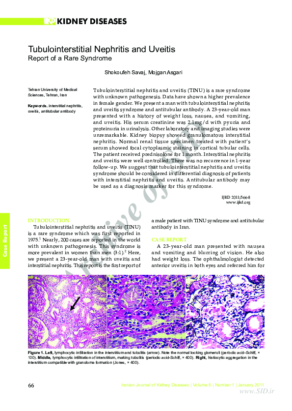 (PDF) Tubulointerstitial nephritis and uveitis: report of a rare syndrome