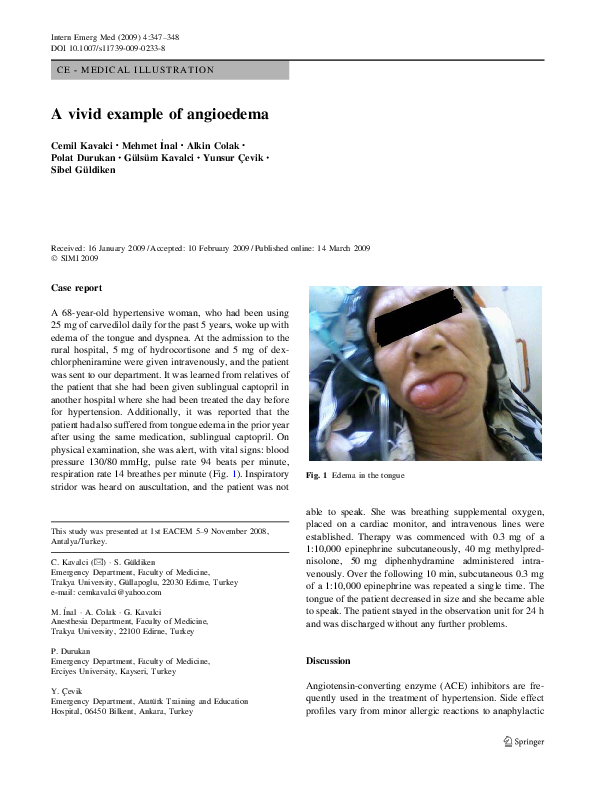 (PDF) A vivid example of angioedema