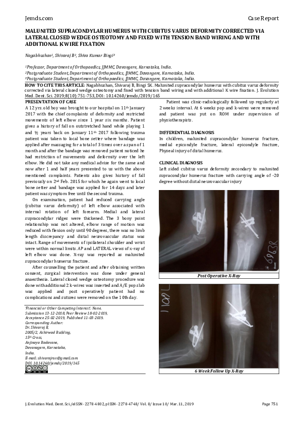 (PDF) Malunited Supracondylar Humerus with Cubitus Varus Deformity ...