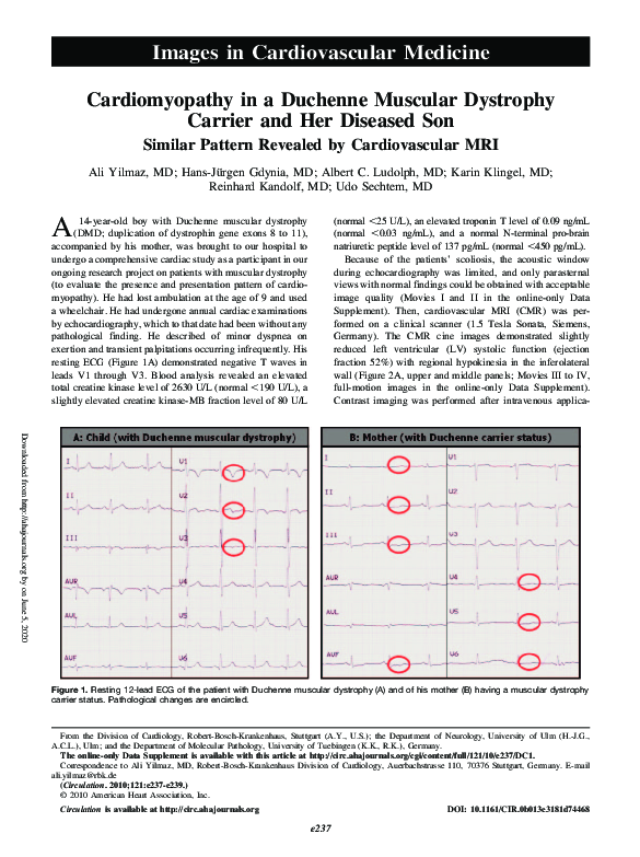 (PDF) Cardiomyopathy in Duchenne muscular dystrophy: pathogenesis and ...