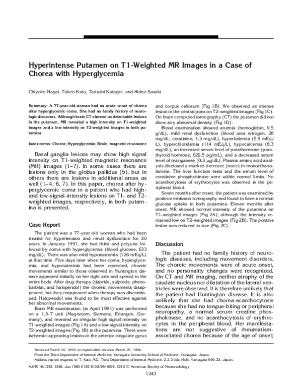(PDF) Hyperintense putamen on T1-weighted MR images in a case of chorea ...