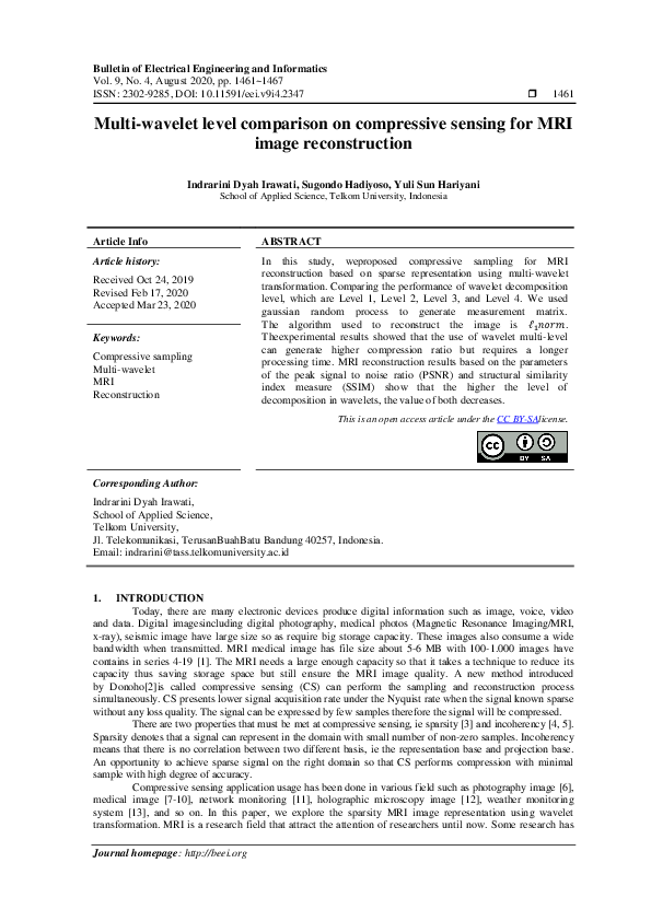 (PDF) Multi-wavelet level comparison on compressive sensing for MRI image reconstruction