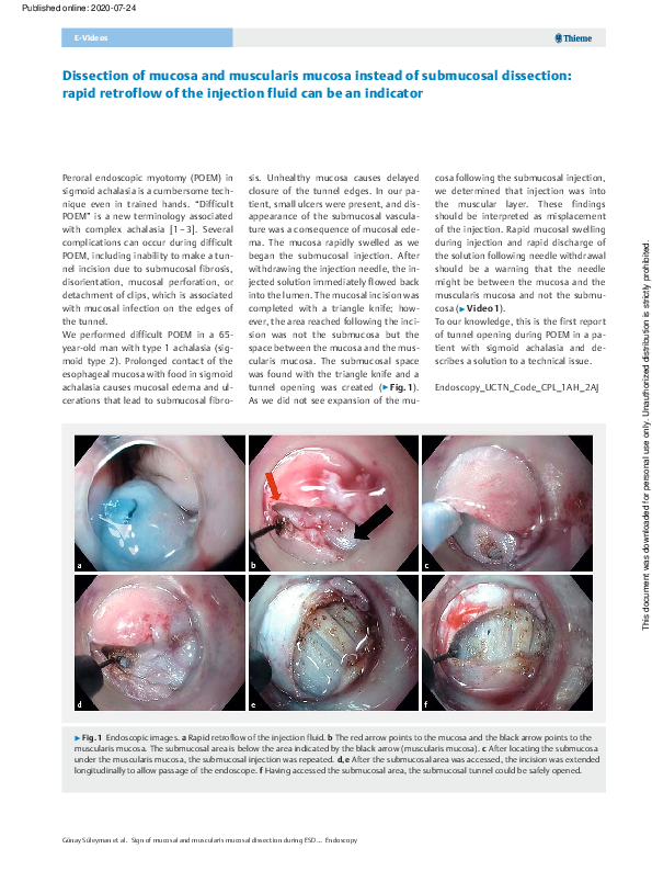 (PDF) Dissection of mucosa and muscularis mucosa instead of submucosal ...
