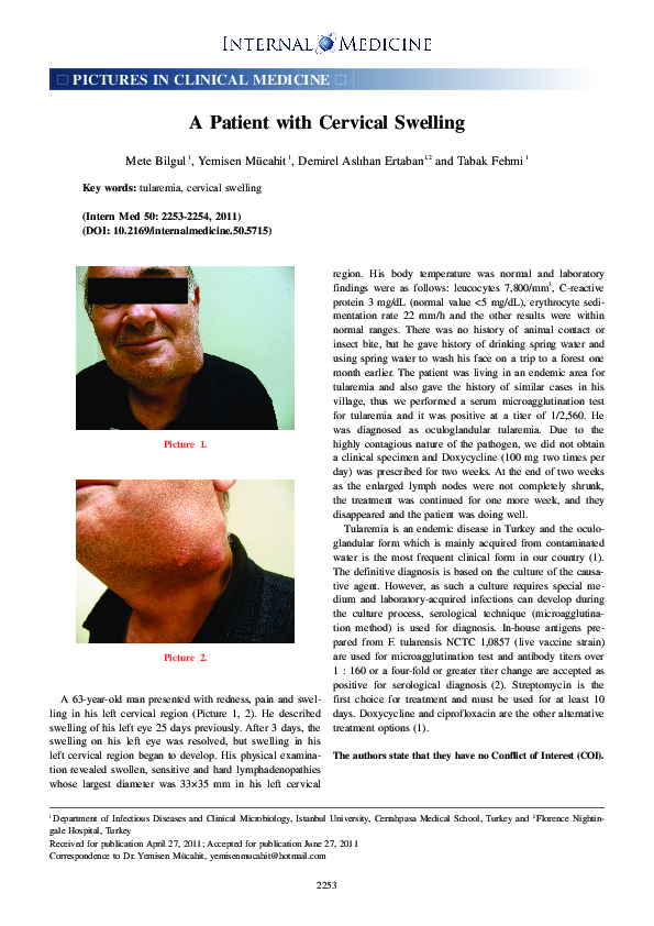 (PDF) A Patient with Cervical Swelling