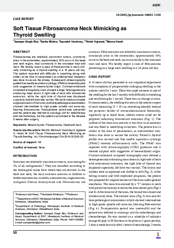 (PDF) Soft Tissue Fibrosarcoma Neck Mimicking as Thyroid Swelling