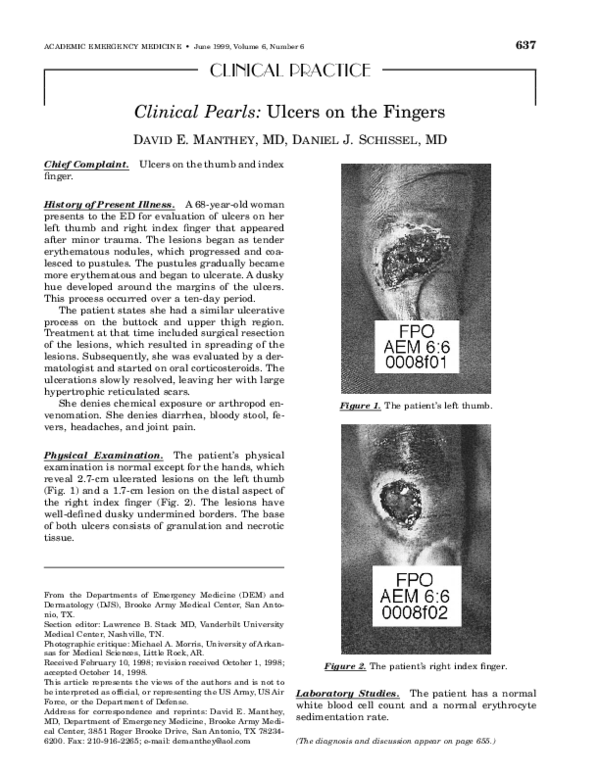 (PDF) Clinical Pearls: Ulcers on the Fingers