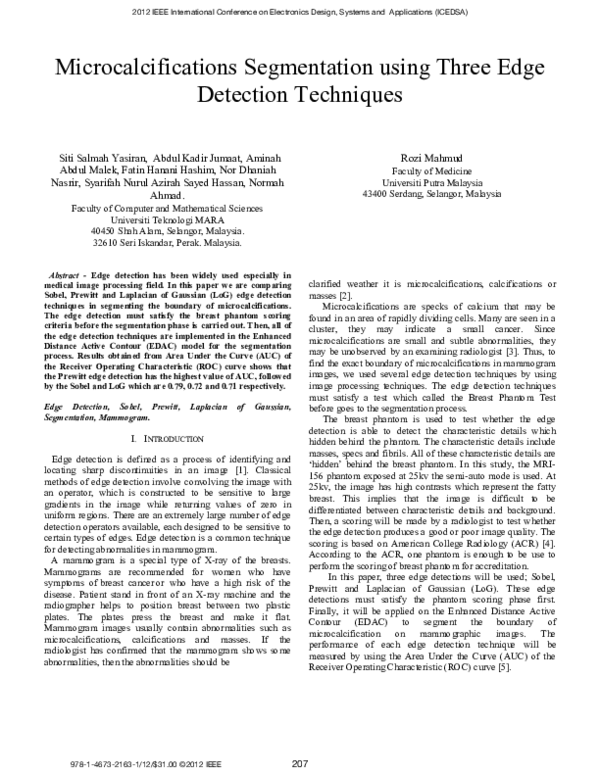 Pdf Microcalcifications Segmentation Using Three Edge Detection Techniques Rozi Mahmud