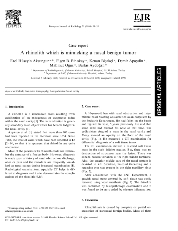 (PDF) A rhinolith which is mimicking a nasal benign tumor
