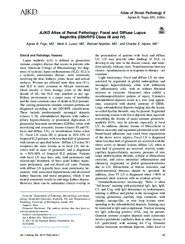 (PDF) AJKD Atlas of Renal Pathology: Focal and Diffuse Lupus Nephritis ...