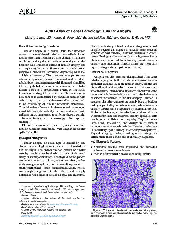 (PDF) AJKD Atlas of Renal Pathology: Tubular Atrophy