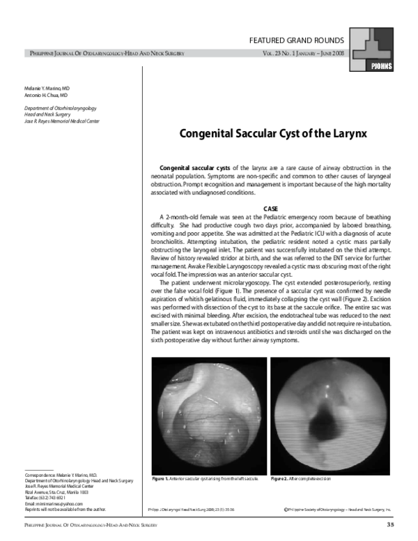 (PDF) Congenital Saccular Cyst of the Larynx