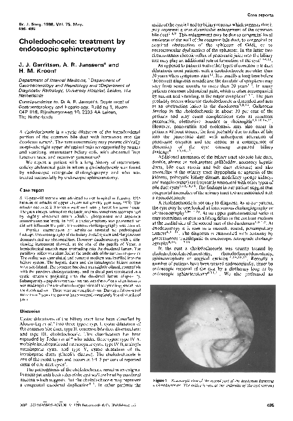(PDF) Choledochocele: Treatment by endoscopic sphincterotomy