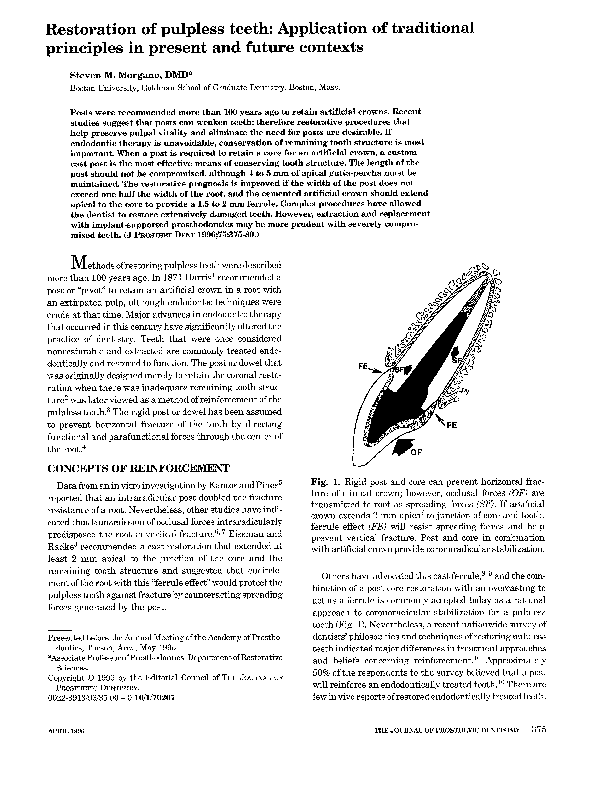 (PDF) Restoration of pulpless teeth: Application of traditional ...