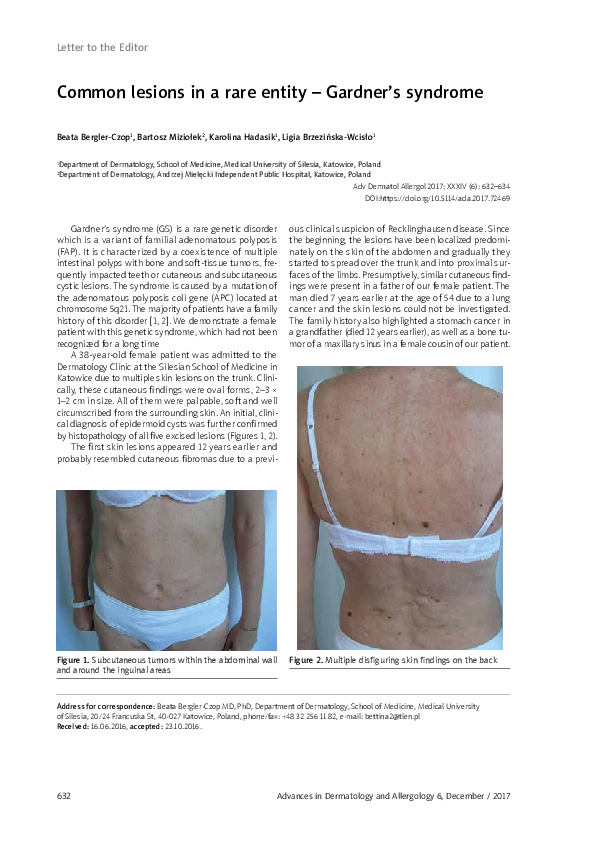 (PDF) Common lesions in a rare entity – Gardner’s syndrome