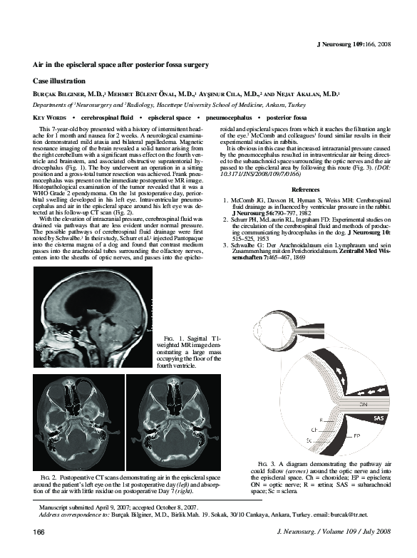 (PDF) Air in the episcleral space after posterior fossa surgery ...