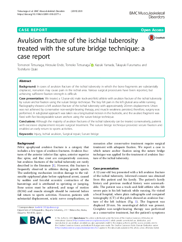 (PDF) Avulsion fracture of the ischial tuberosity treated with the ...