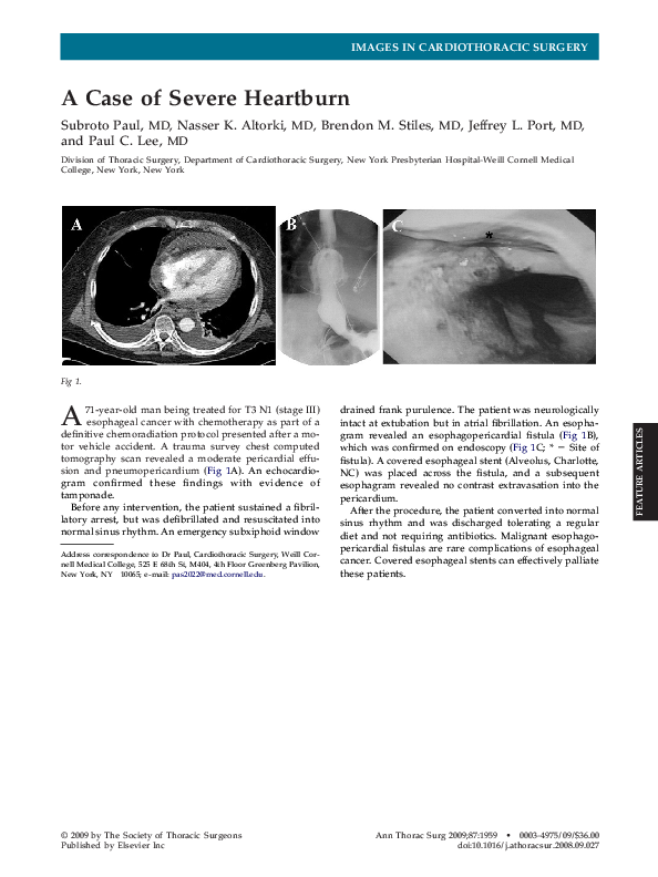 (PDF) A Case of Severe Heartburn