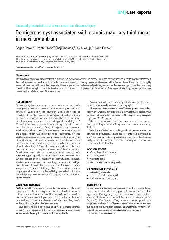 (PDF) Dentigerous cyst associated with ectopic maxillary third molar in ...