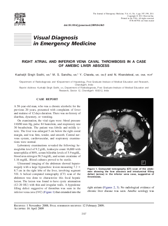 (PDF) Right Atrial and Inferior Vena Caval Thrombosis in a Case of ...