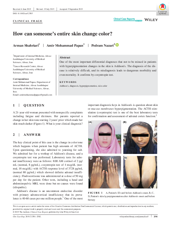 (PDF) How can someone’s entire skin change color? | Pedram Nazari ...