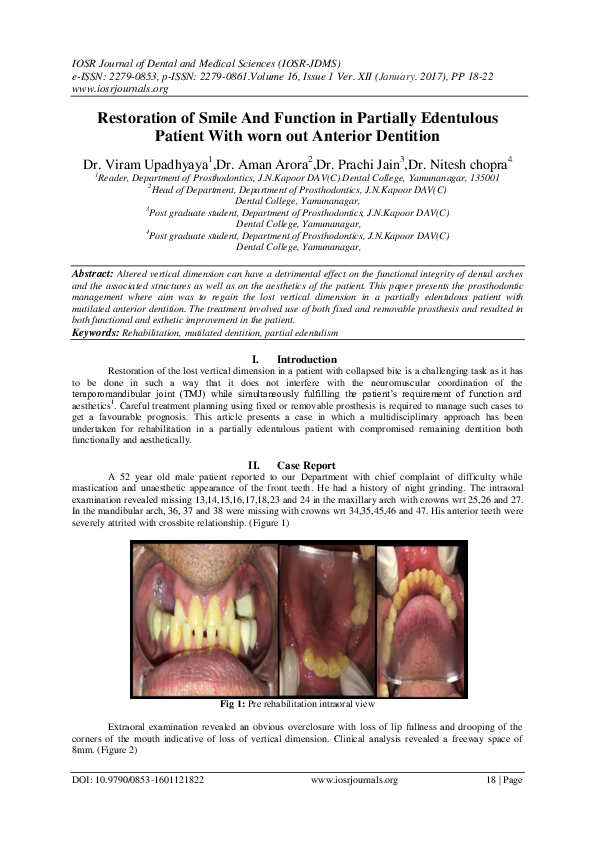 (PDF) Restoration of Smile And Function in Partially Edentulous Patient ...