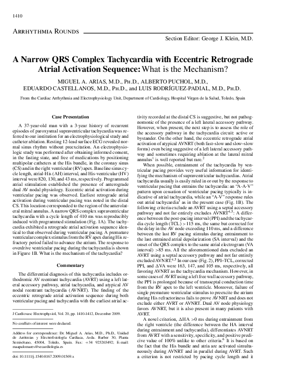 (PDF) Eccentric Retrograde Atrial Activation Mechanism