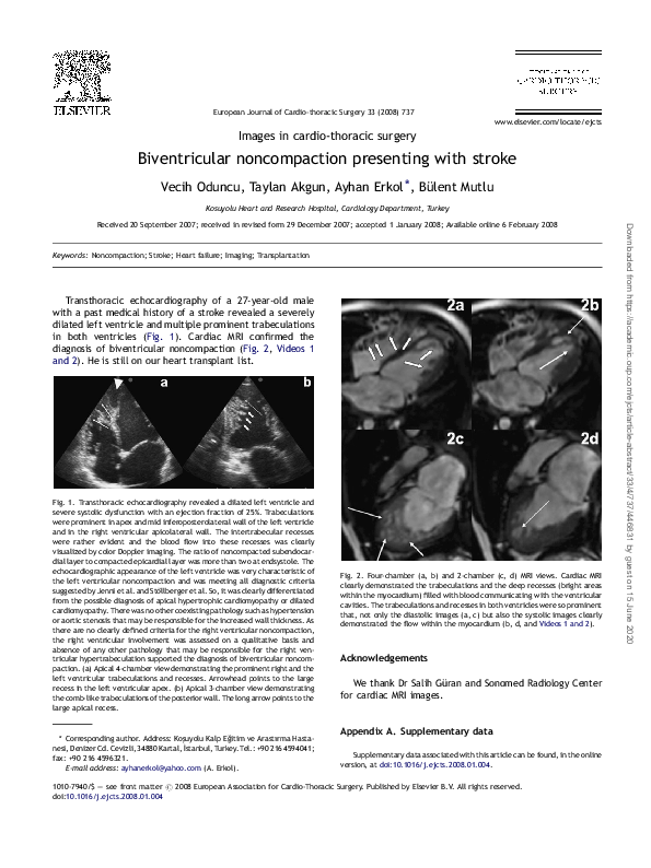 (PDF) Biventricular noncompaction presenting with stroke