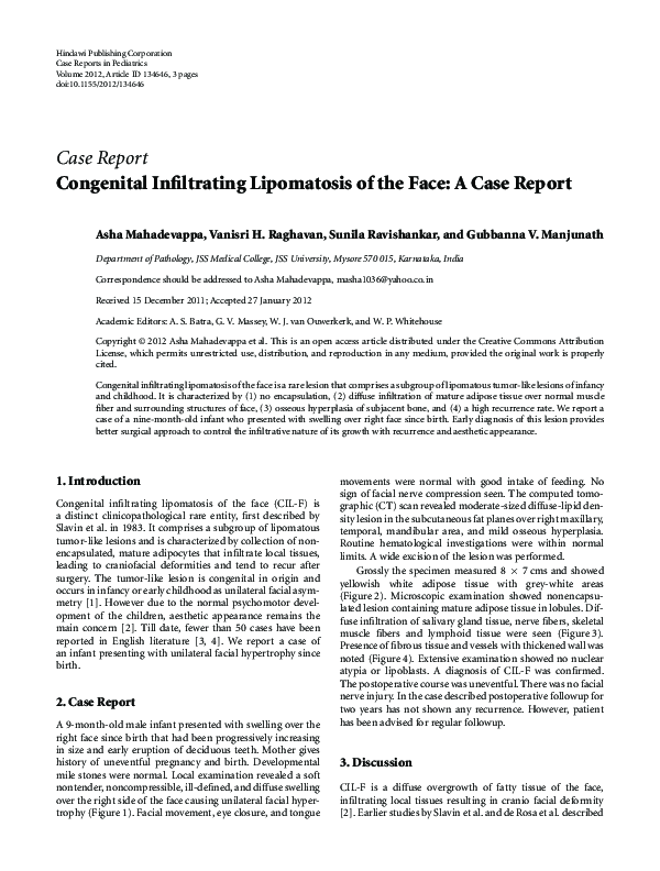 (PDF) Congenital Infiltrating Lipomatosis of the Face: A Case Report ...
