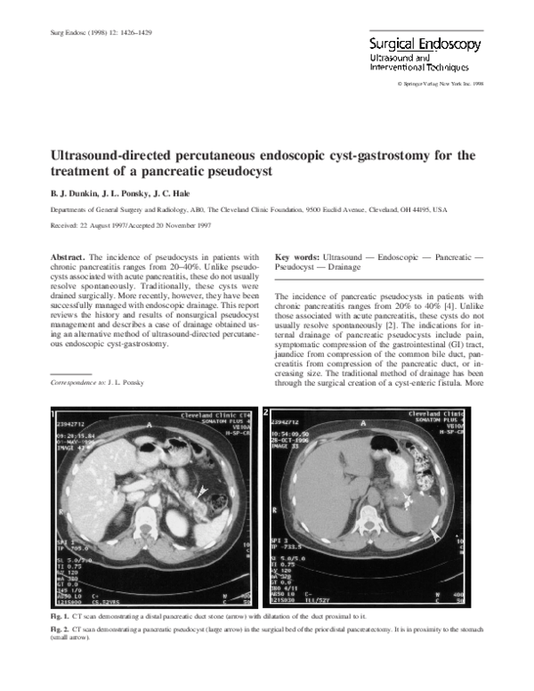 (PDF) Ultrasound-directed percutaneous endoscopic cyst-gastrostomy for ...