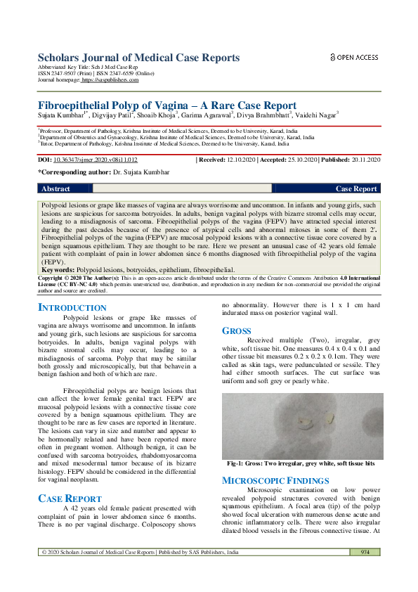 Pdf Fibroepithelial Polyp Of Vagina A Rare Case Report Divya