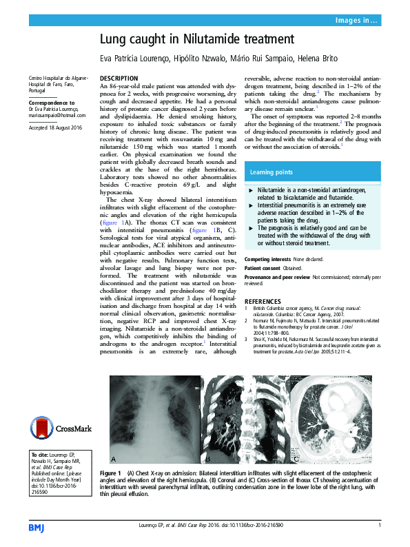 (PDF) Lung caught in Nilutamide treatment