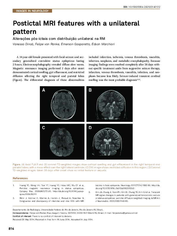 (PDF) Postictal MRI features with a unilateral pattern