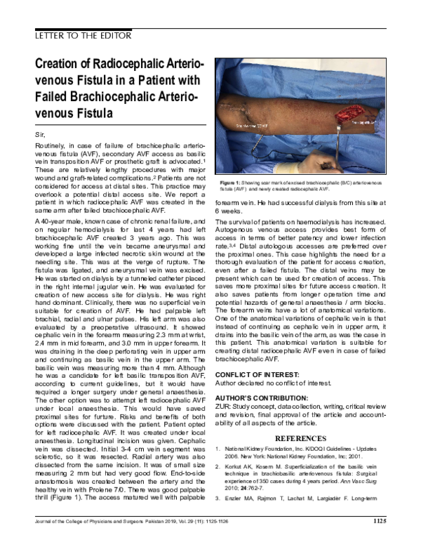 (PDF) Creation of Radiocephalic Arteriovenous Fistula in a Patient with ...