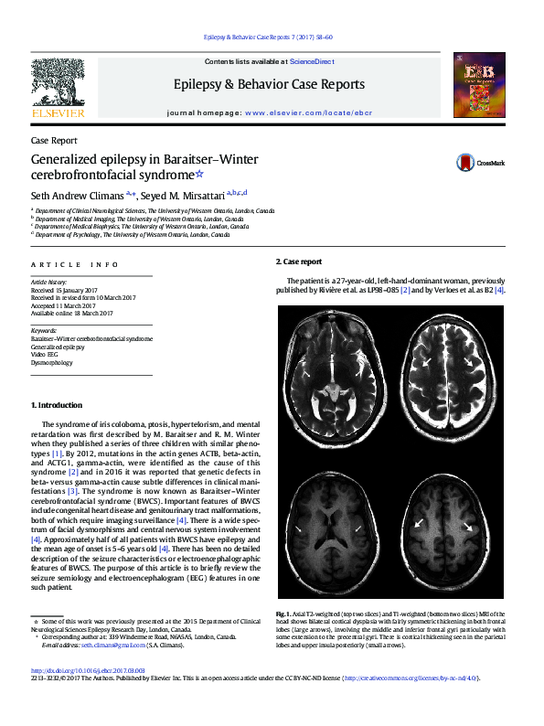 (PDF) Generalized Epilepsy in Baraitser–Winter Cerebrofrontofacial Syndrome