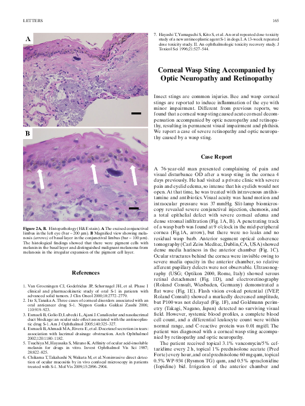 (PDF) Wasp Sting-Induced Optic Neuropathy Case